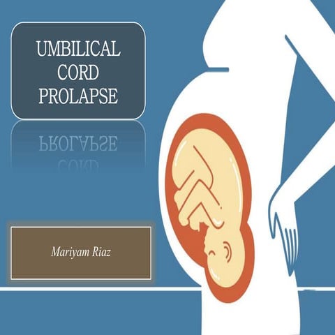 Umbilical cord prolapse | PPTX