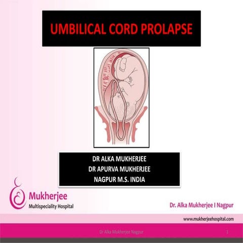 Cord prolapse & cord presentation | PPTX