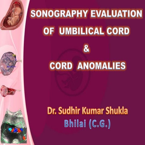 Umblical cord | PPTX