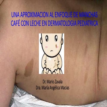 UNA APROXIMACION AL ENFOQUE DE MANCHAS CAFÉ CON leche.pptx | Medical Health