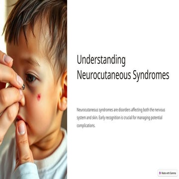 Understanding-Neurocutaneous-Syndromes.pptx