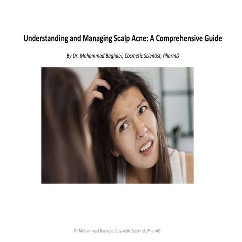 Understanding and Managing Scalp Acne, A Comprehensive Guide pptx | PPT