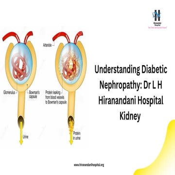 Understanding Diabetic Nephropathy Dr L H Hiranandani Hospital Kidney ...