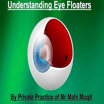 Understanding eye floaters | PDF