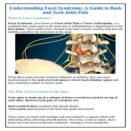 Understanding Facet Syndrome: A Guide to Back and Neck Joint Pain | PDF