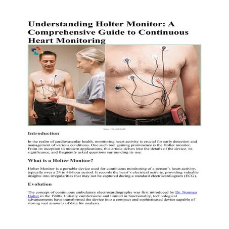 Holter Monitor: A Comprehensive Guide to Continuous Heart Monitoring ...
