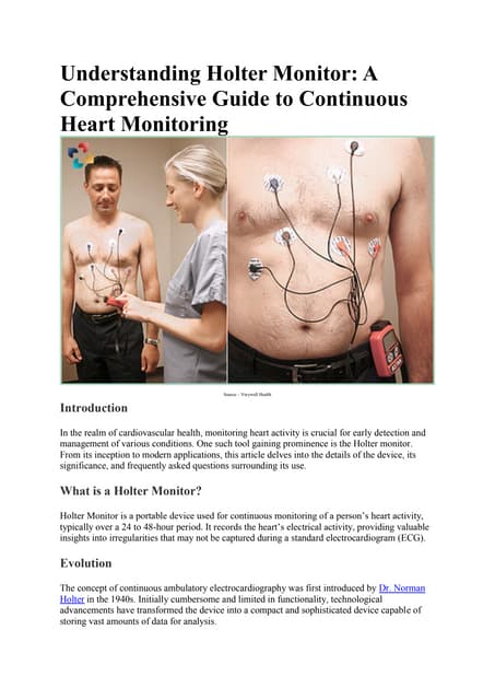 Holter Monitor: A Game-Changer in Heart Health Monitoring | PDF