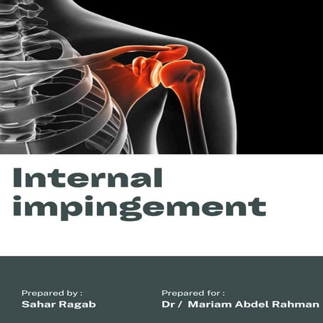 _Understanding Internal Impingement_A Comprehensive Guide_.pdf
