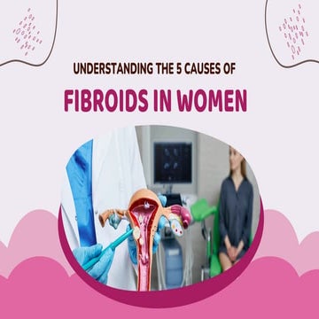 UNDERSTANDING THE 5 CAUSES OF FIBROIDS IN WOMEN | PPT