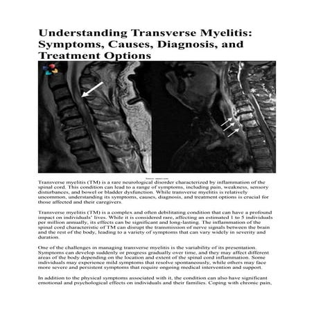 Transverse Myelitis: Symptoms, Causes, Diagnosis, and Treatment Options ...