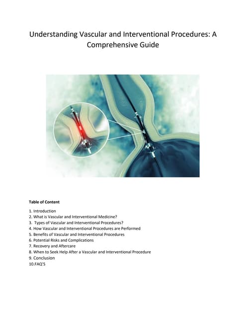 Common Procedures in Interventional Radiology | PPTX