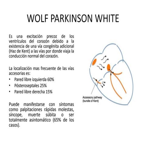 Wolf Parkinson White | PDF