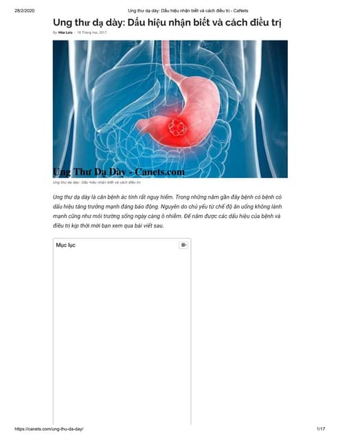 Benh ung thu da day la gi Dau hieu nhan biet som va cach phong benh.pdf