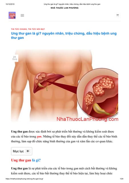 UNG THƯ GAN NGUYÊN PHÁT | PDF