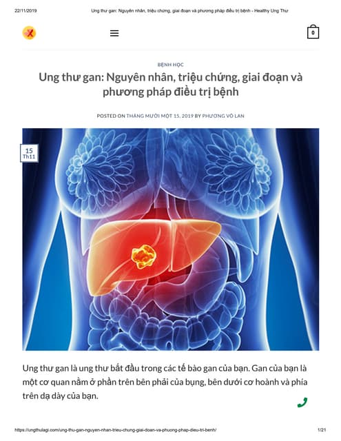 Tổng quan về ung thư vú (Dịch tễ, yếu tố nguy cơ) | DOCX