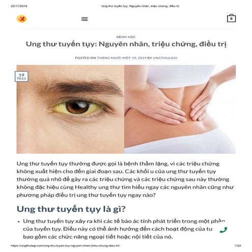 Ung thu tuyen tuy nguyen nhan trieu chung dau hieu phuong phap dieu tri hieu qua nhat | PDF