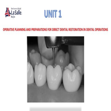 Cavosurface margins in various restorations /certified fixed ...