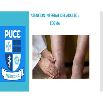 UNIDAD 3 EDEMA DIAPOSITIVAS SOBRE EL TEMA INCLUYENDO CASO CLÍNICO.pptx
