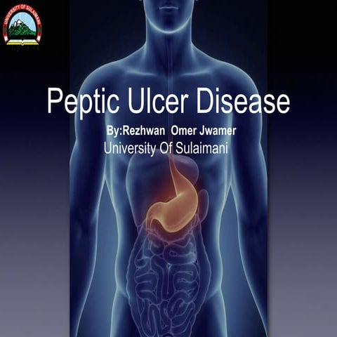 Peptic Ulcer | PPTX