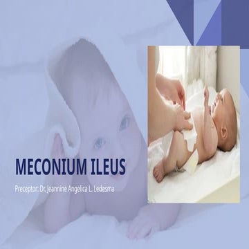 meconium ileus from pediatrics department.pptx