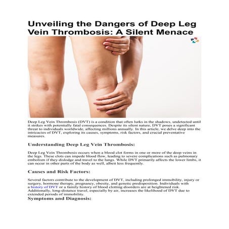 Deep Leg Vein Thrombosis (DVT): Meaning, Causes, Symptoms, Treatment ...