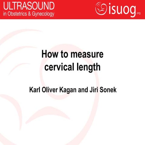 How to measure cervical length | PPT