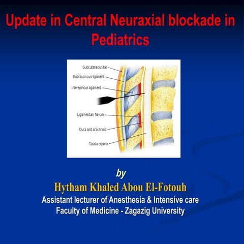 Update in Central Neuraxial Blockade in Pediatrics | PDF