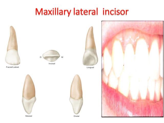 Upper First Molar | PPT
