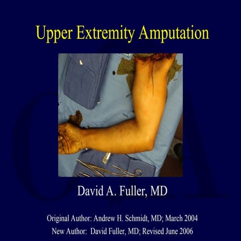 upper EXtrimity ( upper limb) amputation.ppt