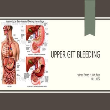 Upper git bleeding | PPTX