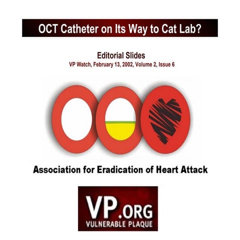161 oct catheter | PPT