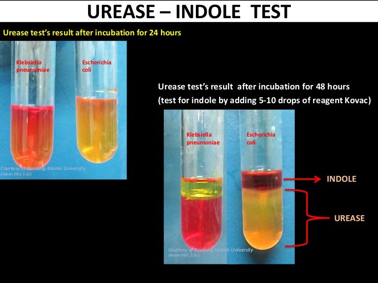 Escherichia coli & Klebsiella pneumoniae (UNISBA - Indonesia)