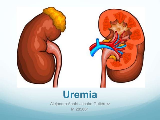 Approach to the Patient with Renal Disease