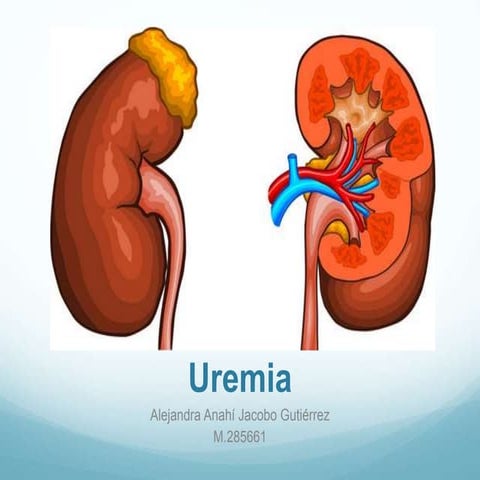 Uremia | PPTX