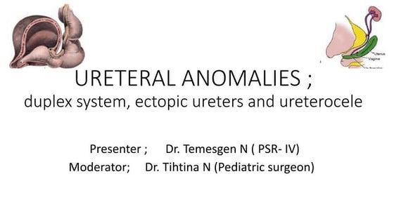 Ureterocele Symptoms, Causes, Diagnosis and Treatment (1).pptx | Surgery | Medical Health