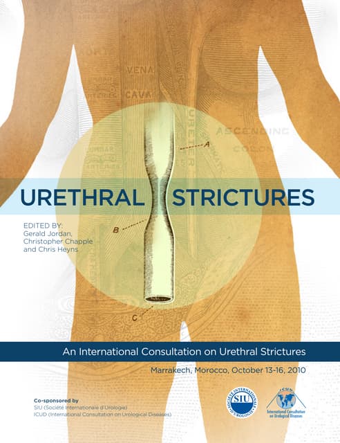 OIU review article | PPTX | Surgery | Medical Health