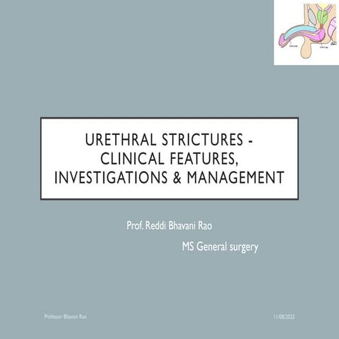 Urethral Strictures, causes and management | PPTX