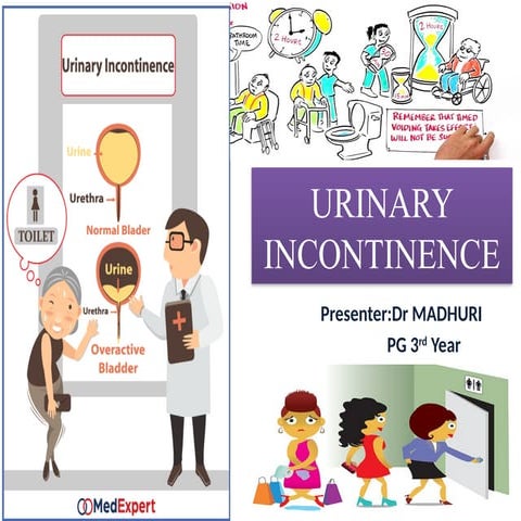 Urinary-incontenince.pptx urge and stress incontinence | PPTX