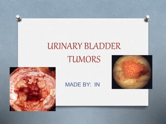 Small Cell Carcinoma of the Bladder | PPT