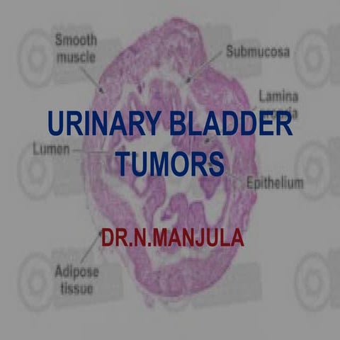 URINARY BLADDER TUMORS .pptx