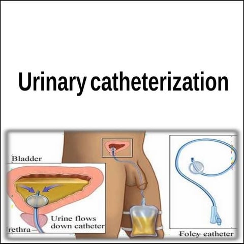 Catheterization | PPTX