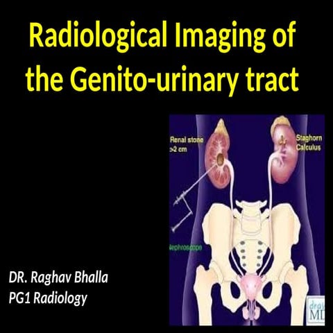 Comprehensive Radiological Imaging of the Genito-Urinary Tract ...