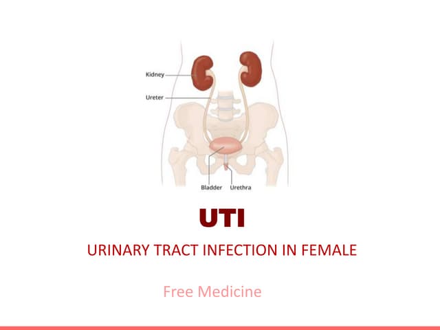 Management of UTI.pptx