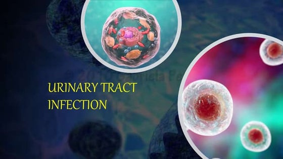 Urinary tract infection | PPTX