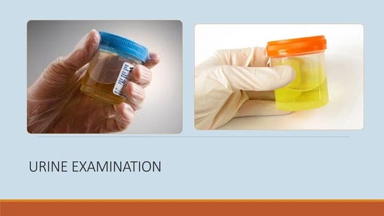 Abnormal constituents of urine | PPTX | Diabetes | Diseases and Conditions