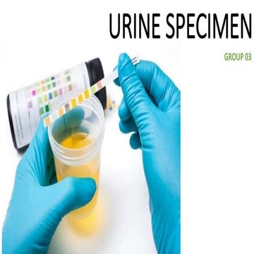 URINE SPECIMEN.pptx