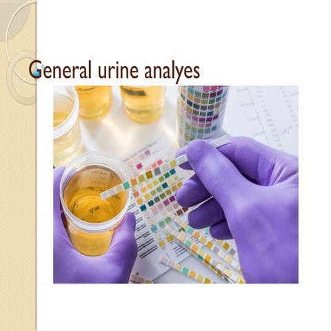 URINE TEST.pptxdhxjckcjcjcjcjcjcjcjcjvjcjcjcj | PPT