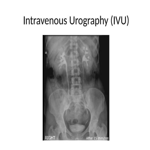 urography.pptxpppppppppppppppppppppppppppppppppppppp | PPT