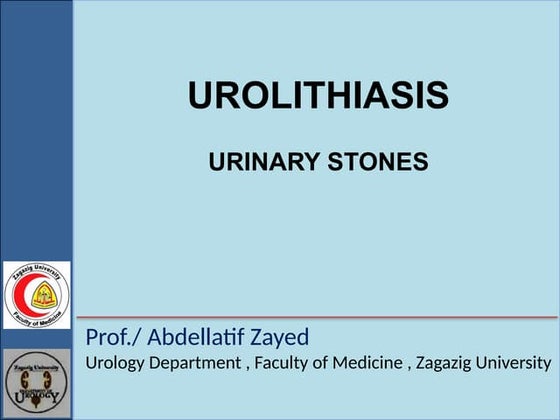 Urolithiasis Urolithiasis Urolithiasis.pptx