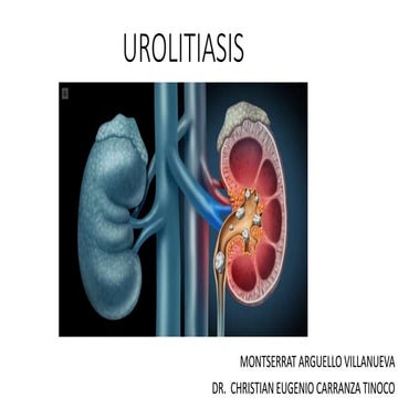 UROLITIASIS.pptx